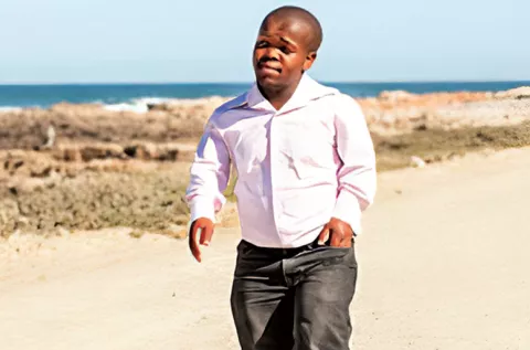 Hypopituitary Dwarfism Vs Achondroplasia