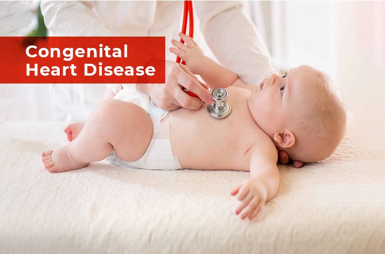Congenital Heart Defects Babies