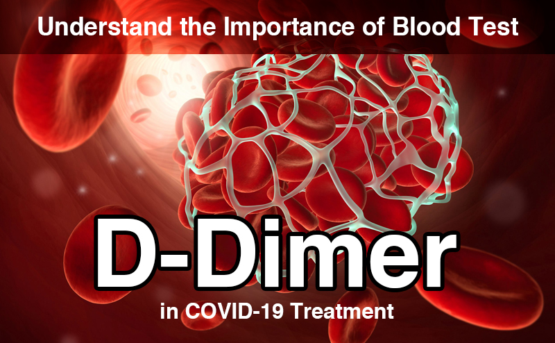 D-DIMER – GREATEST HARBINGER OF COVID-19 COMPLICATIONS…