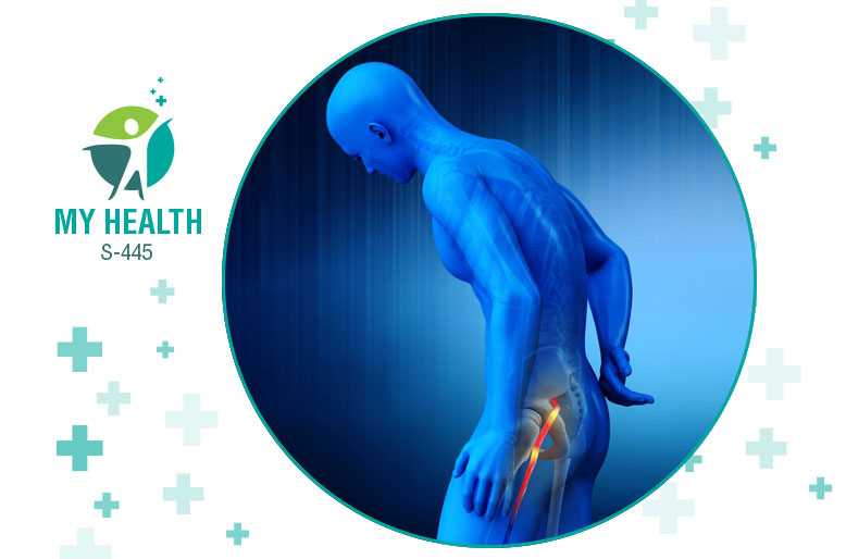 The Sciatica Survival Guide Managing Pain And Finding Relief