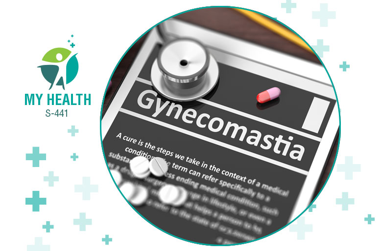 Gynecomastia: An In-depth Look at Causes and Symptoms