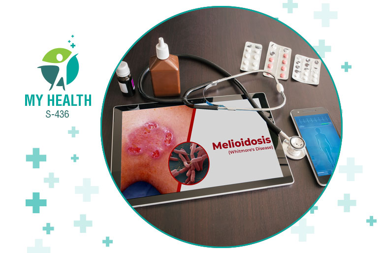 Melioidosis: A Forgotten Disease Making a Deadly Comeback