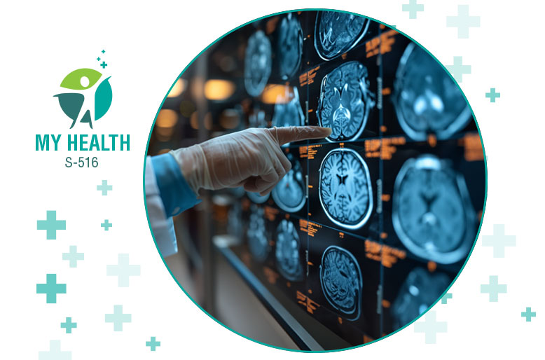 Understanding Bulbar Palsy: Symptoms, Causes, and Effective Management ...