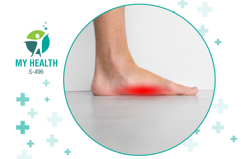 Understanding Flat Foot: A Comprehensive Guide to Causes, Care, and Cure.