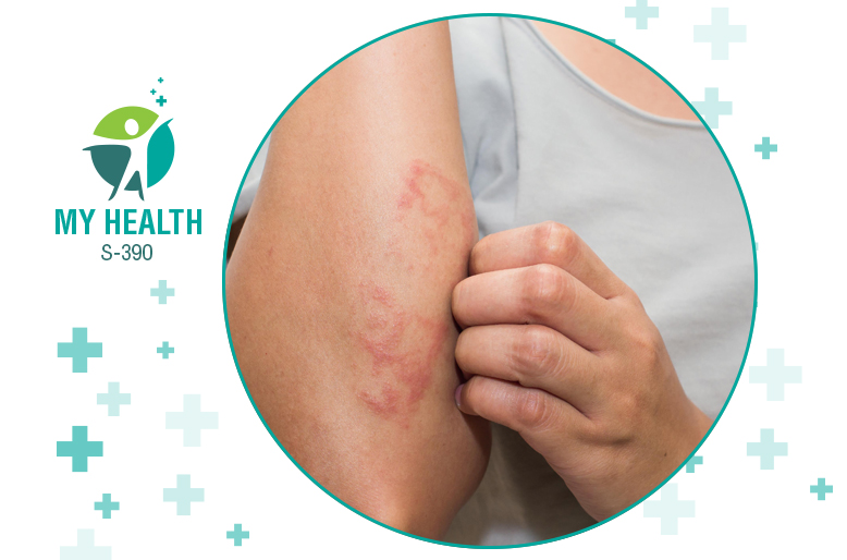 Atopic dermatitis: Protect Your Skin
