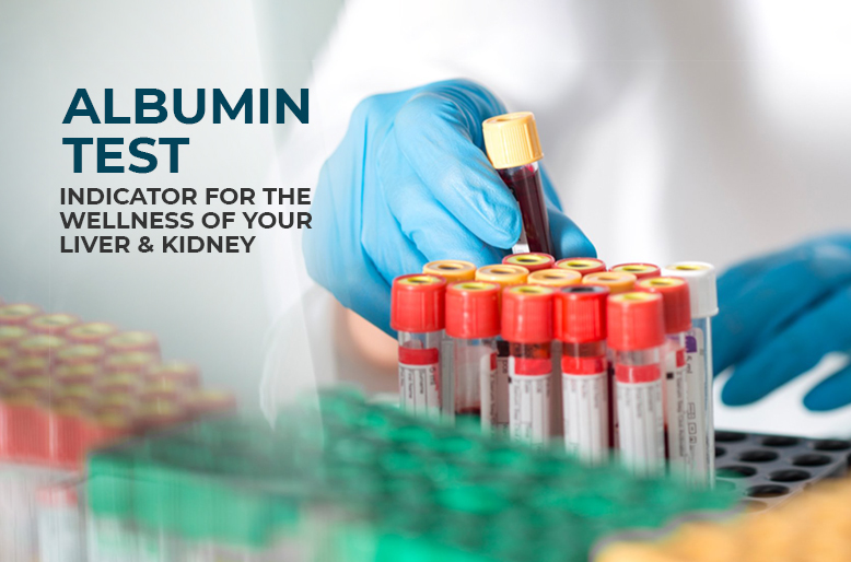 ALBUMIN TEST - INDICATOR FOR THE WELLNESS OF YOUR LIVER & KIDNEY…