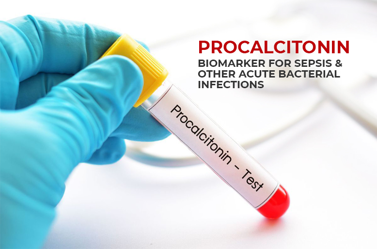 PROCALCITONIN – BIOMARKER FOR SEPSIS & OTHER ACUTE BACTERIAL INFECTIONS…