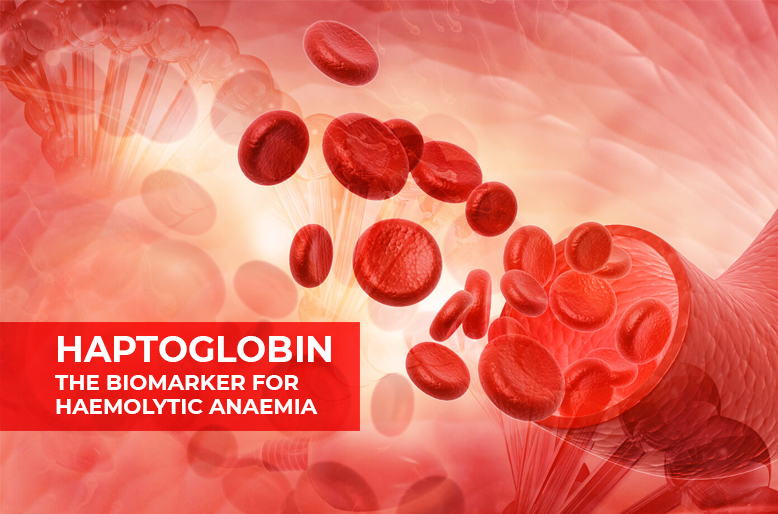 HAPTOGLOBIN – THE BIOMARKER FOR HAEMOLYTIC ANAEMIA…