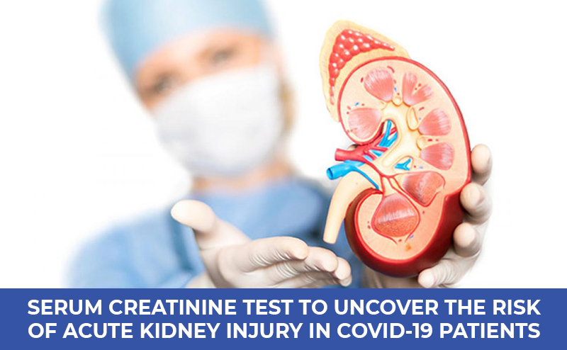 SERUM CREATININE TEST TO UNCOVER THE RISK OF ACUTE KIDNEY INJURY IN ...