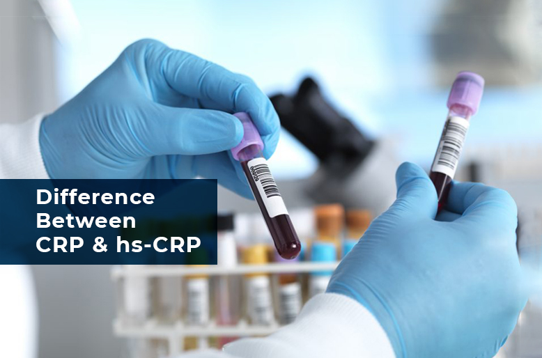 Know the Difference Between Regular CRP Test and hs-CRP Test