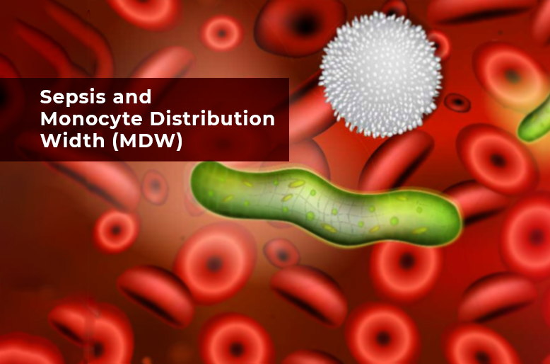 Learn about Sepsis and Monocyte distribution width in detail