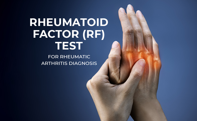 RHEUMATOID FACTOR (RF) TEST- FOR RHEUMATIC ARTHRITIS DIAGNOSIS
