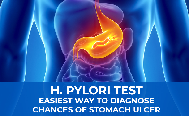 H. PYLORI TEST – EASIEST WAY TO DIAGNOSE CHANCES OF STOMACH ULCER
