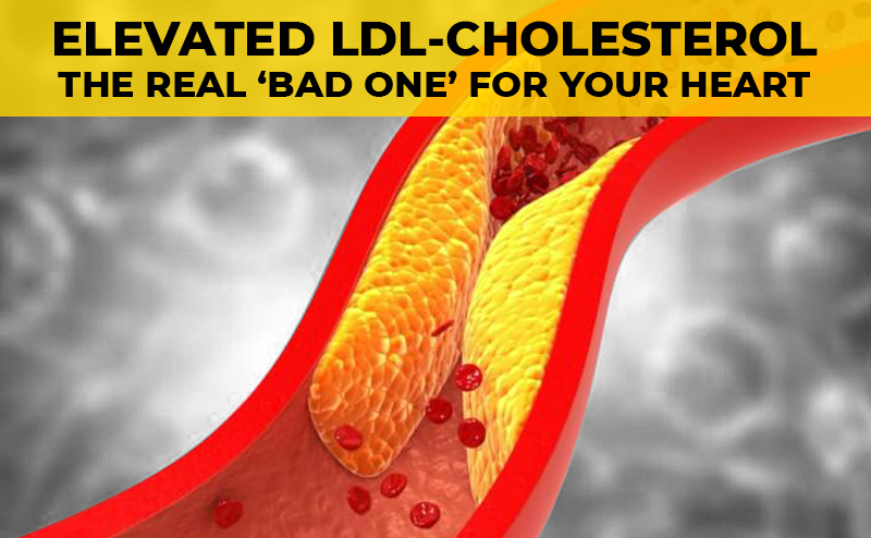 ELEVATED LDL-CHOLESTEROL – THE REAL ‘BAD ONE’ FOR YOUR HEART